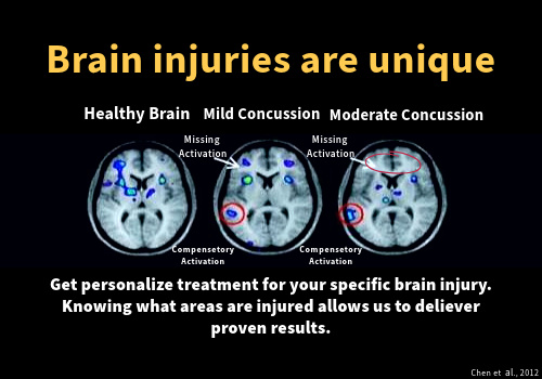 Evidenced based treatment for Concussion, PCS and Depression.