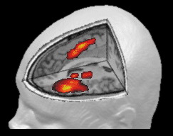 Diagnosing Concussion with functional NeuroCognitive Imaging | Cognitive FX