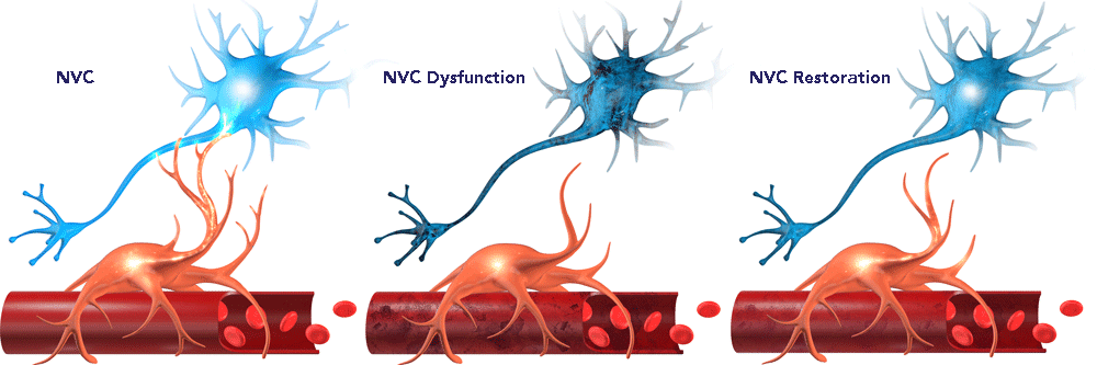 NeuroVascular Coupling the Secret to Recovering from a Concussion