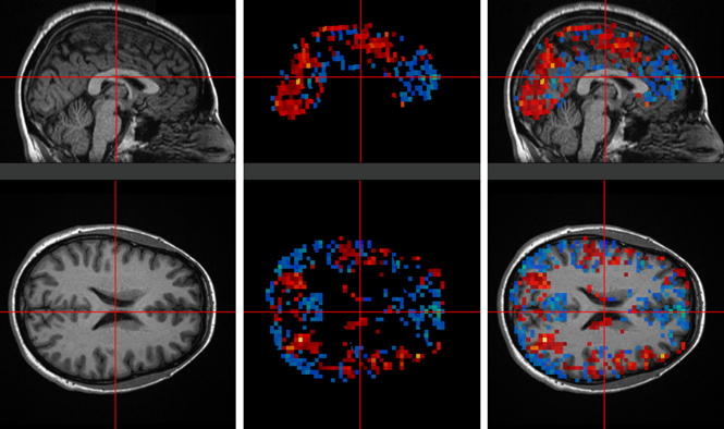 Comprehensive mTBI & Concussion Therapy Tailored to Your Needs