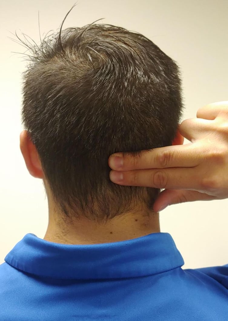 Post-Concussion Syndrome Neck Pain | Cognitive FX