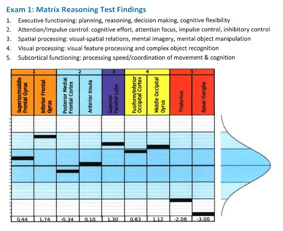 Why Post-Concussion Syndrome Causes Tingling Hands | Cognitive FX