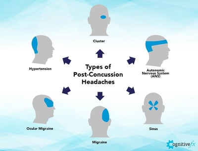 Concussion Headaches or “Post-Traumatic Headaches” | Cognitive FX