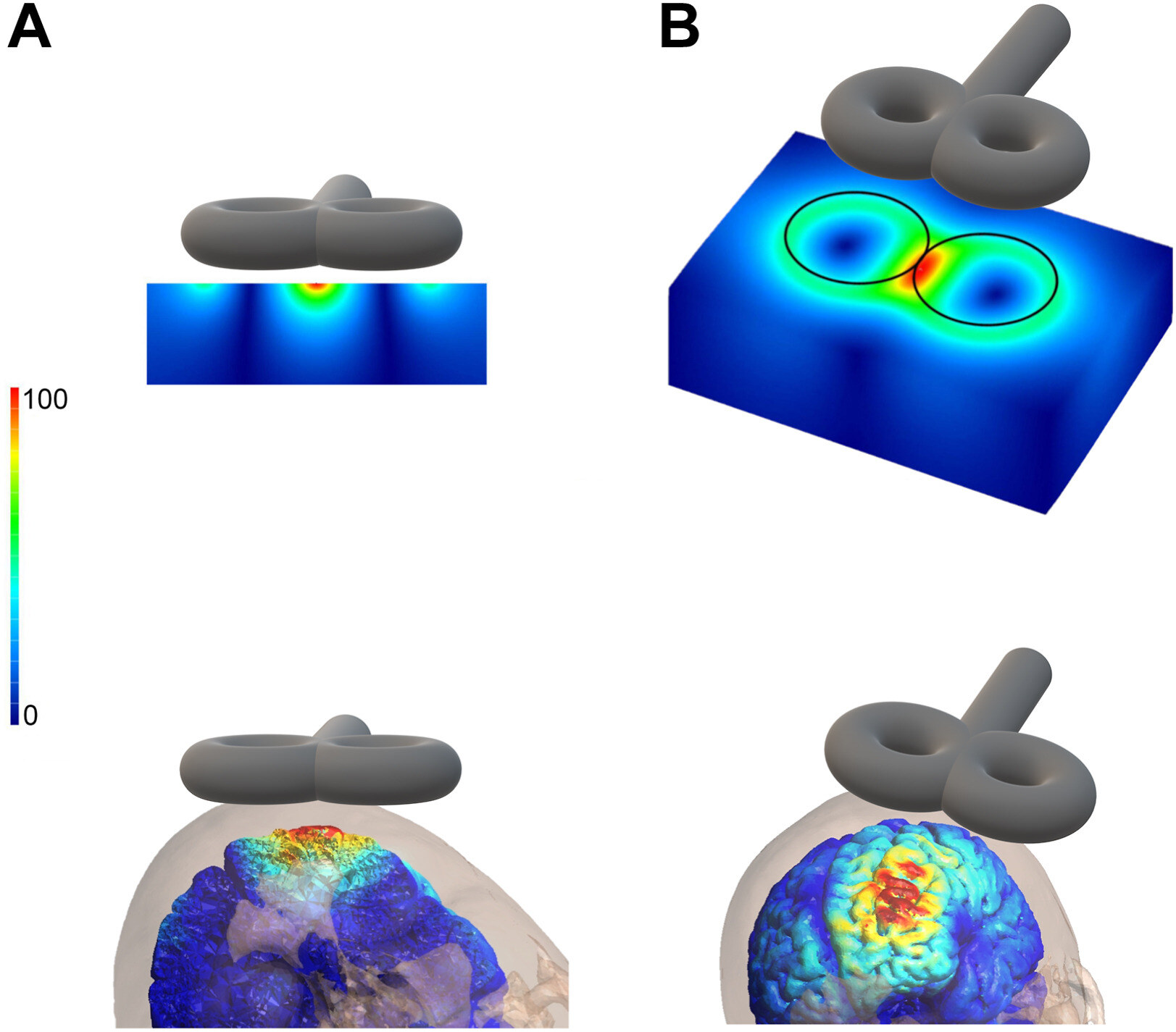 Precision Mental Health - fMRI Guided Transcranial Magnetic Stim