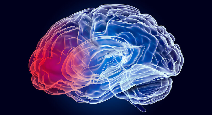 Female Concussion Patient? The Road to Recovery | Cognitive FX