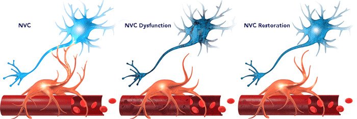 Duke Study on fMRI Brain Scans for Post-Concussion Syndrome Detection